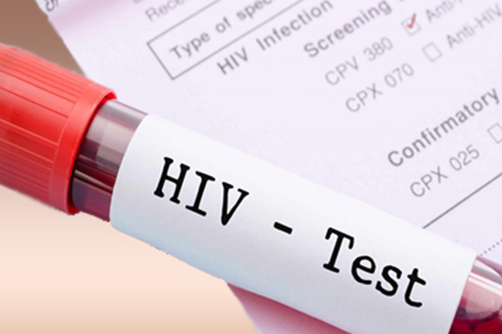 HIV Testing Nationwide Today - Searchlight