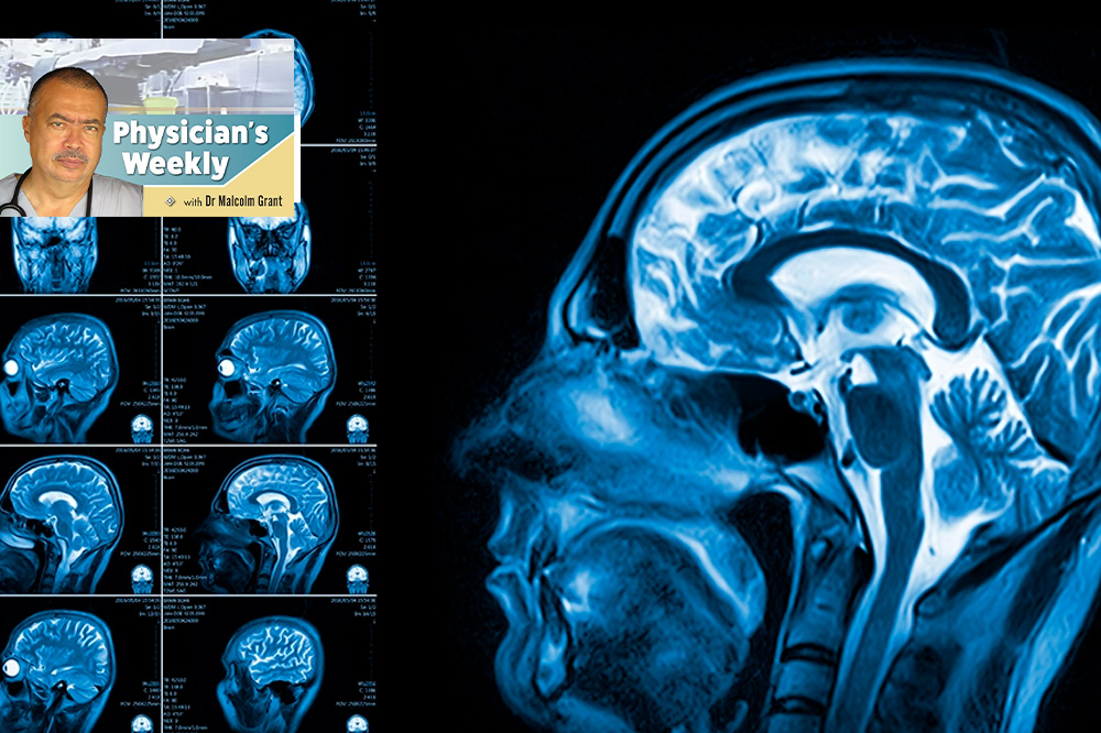 Is a CT Scan or an MRI the better choice for you? - Searchlight