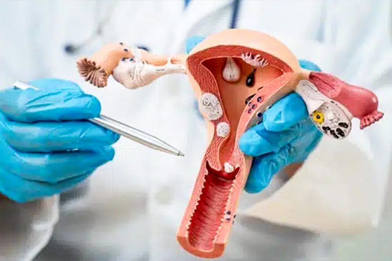 New less invasive treatments expand care options for women with ...
